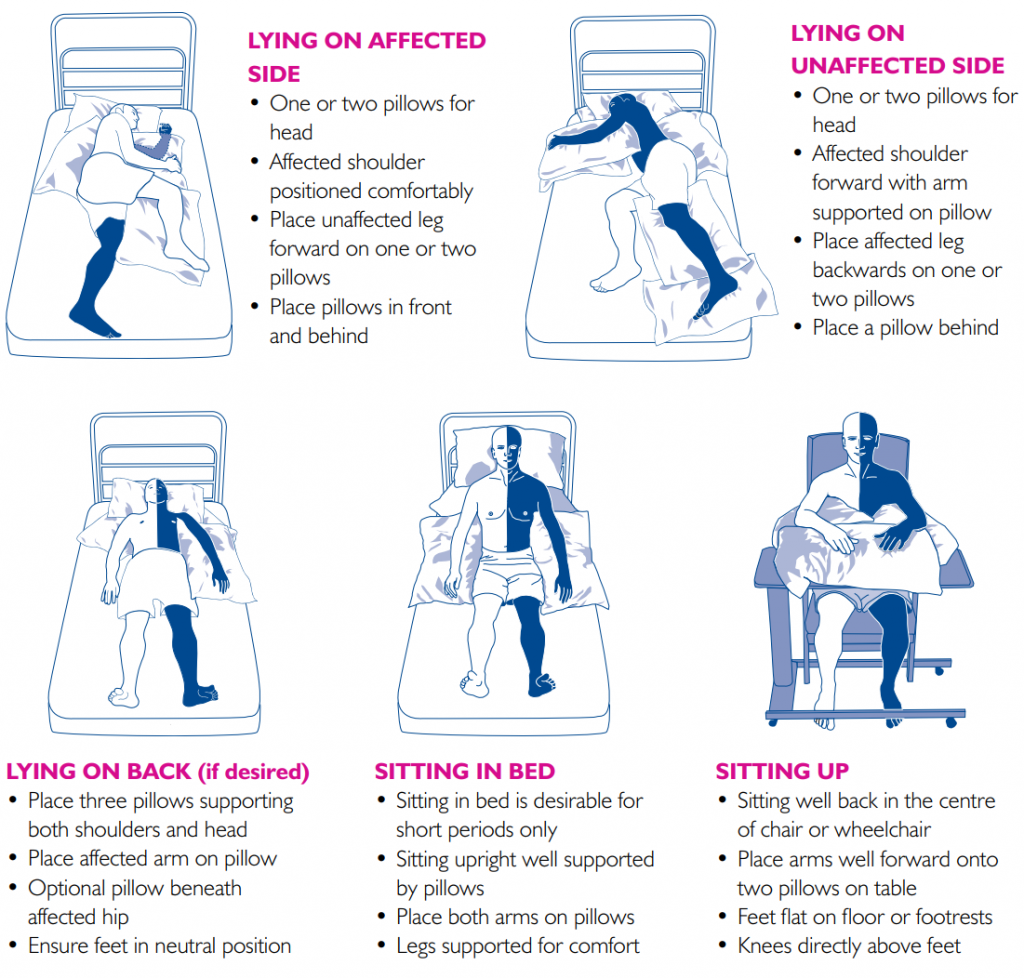 Positioning for people affected by stroke - CHSS eLearning