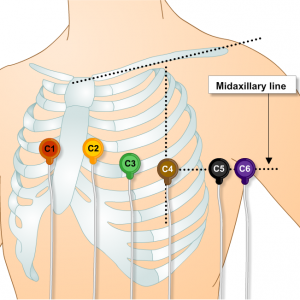 Common Cardiac Investigations Archives - Page 2 of 2 - CHSS eLearning