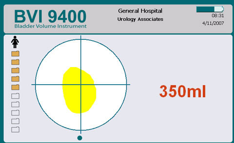 Bladder Scanner - CHSS eLearning
